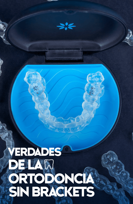 Ortodoncia SIN BRACKETS - Mauricio Gleiser, Odontología Especializada